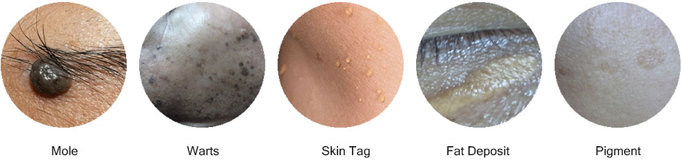 skin-growth – Impression Beauty